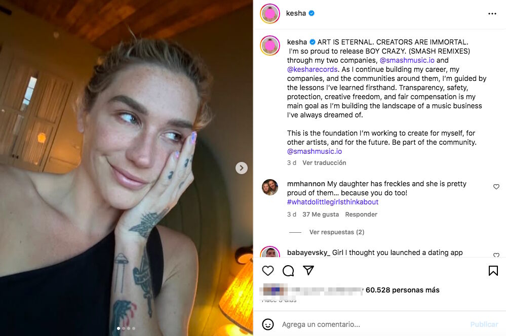 Kesha también se muestra al natural - Foto 16 de 20